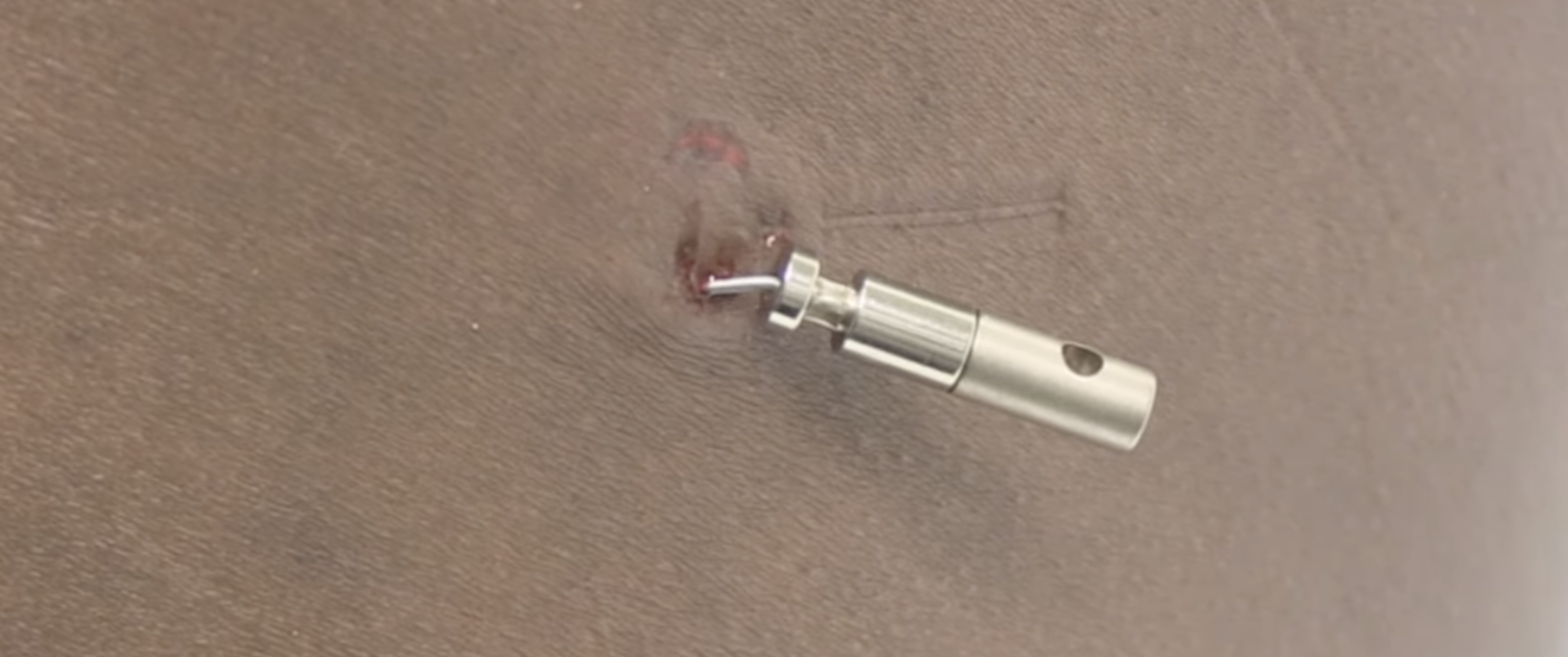 How To Remove Taser Prongs Safely And Effectively? - [March 2026 Update]